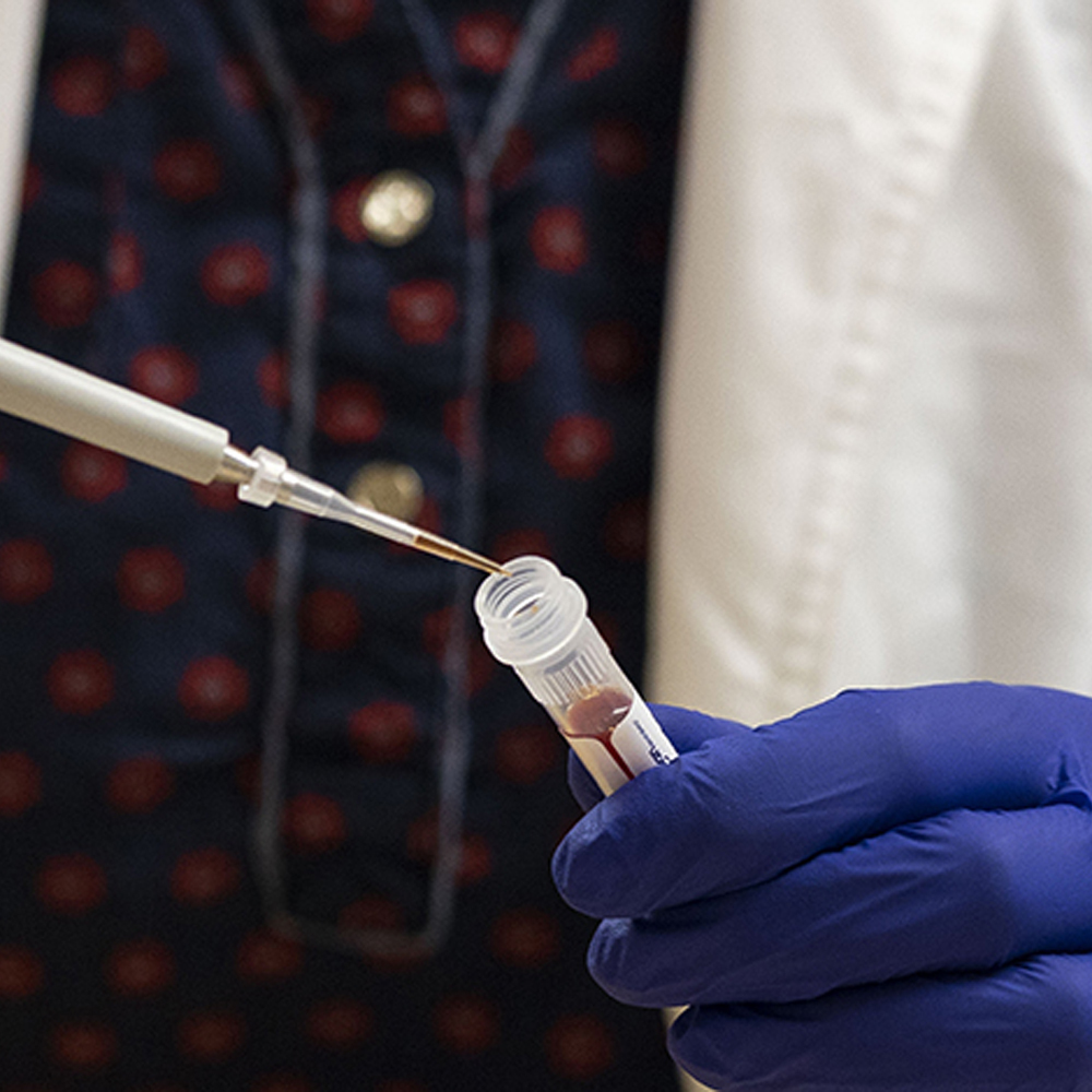 Study uncovers gut bacteria differences in children who later develop ... Study uncovers gut bacteria differences in children who later develop ...
